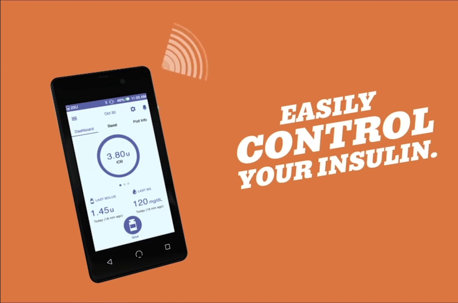 Insulet Omnipod DASH ::: Pompa de insulina PDM – Dexcom CGM | CGM ...