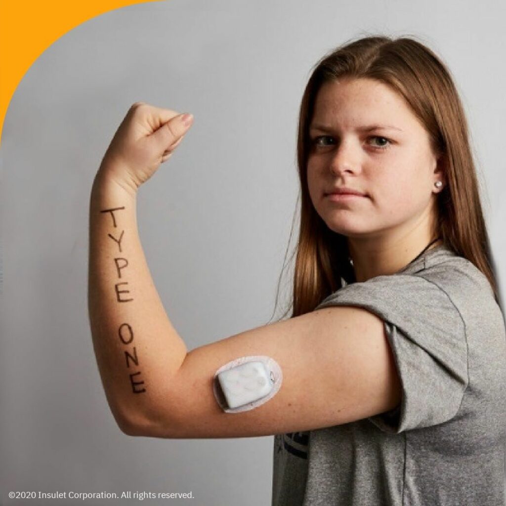 Insulet Omnipod DASH ::: Pompa de insulina PDM – Dexcom CGM | CGM ...